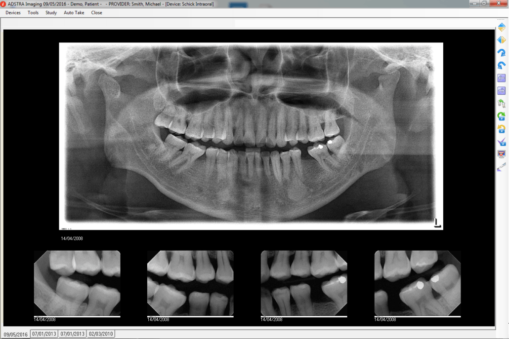 Dental Imaging Software - ADSTRA Imaging™