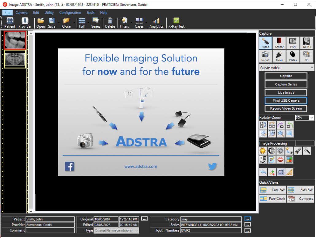 Dental Imaging Software - ADSTRA Imaging™